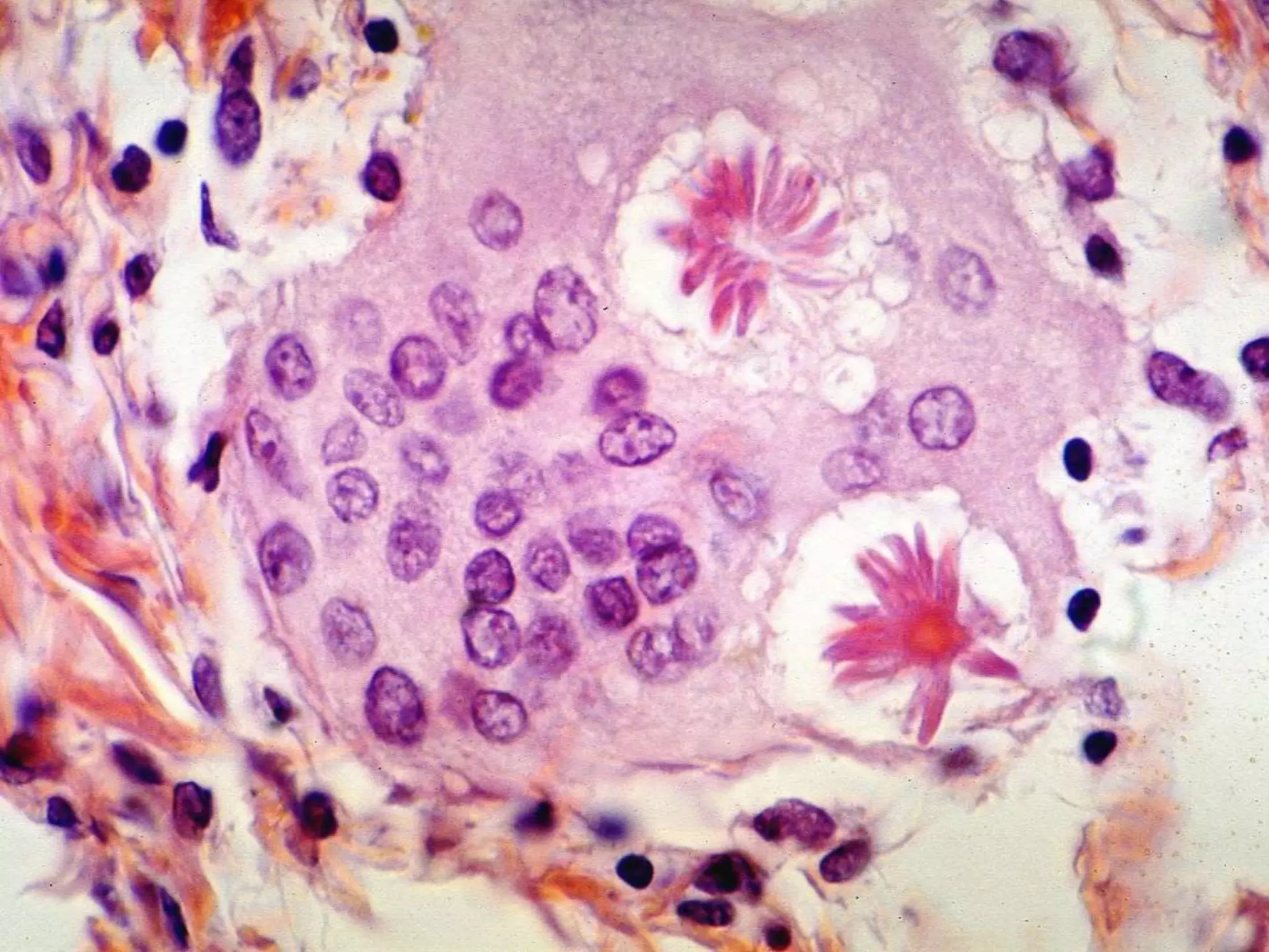 Important bodies in pathology | PPTX