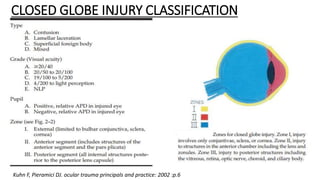 Important considerations in trauma | PPTX