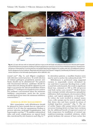 Important developments in_burn_care.41