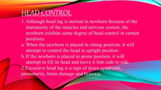 Important measurements of a newborn | PPTX