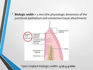 Important values to remember in periodontology.pptx
