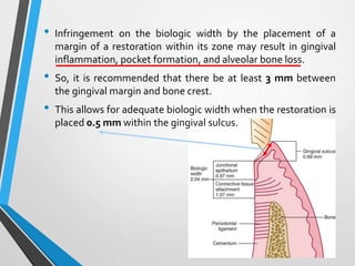 Important values to remember in periodontology.pptx