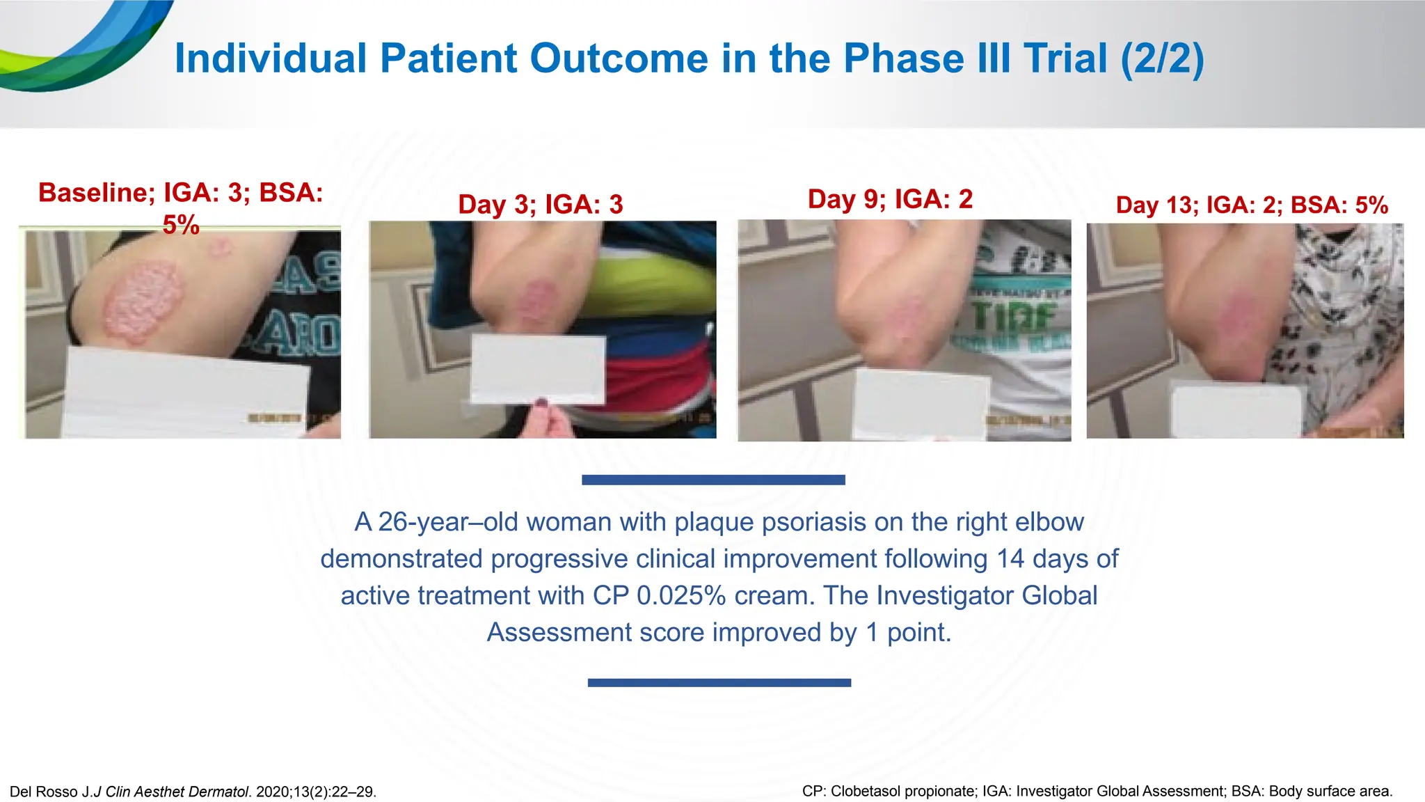'Impoyz Cream Final Slide Deck'.- clobetasol | PPTX
