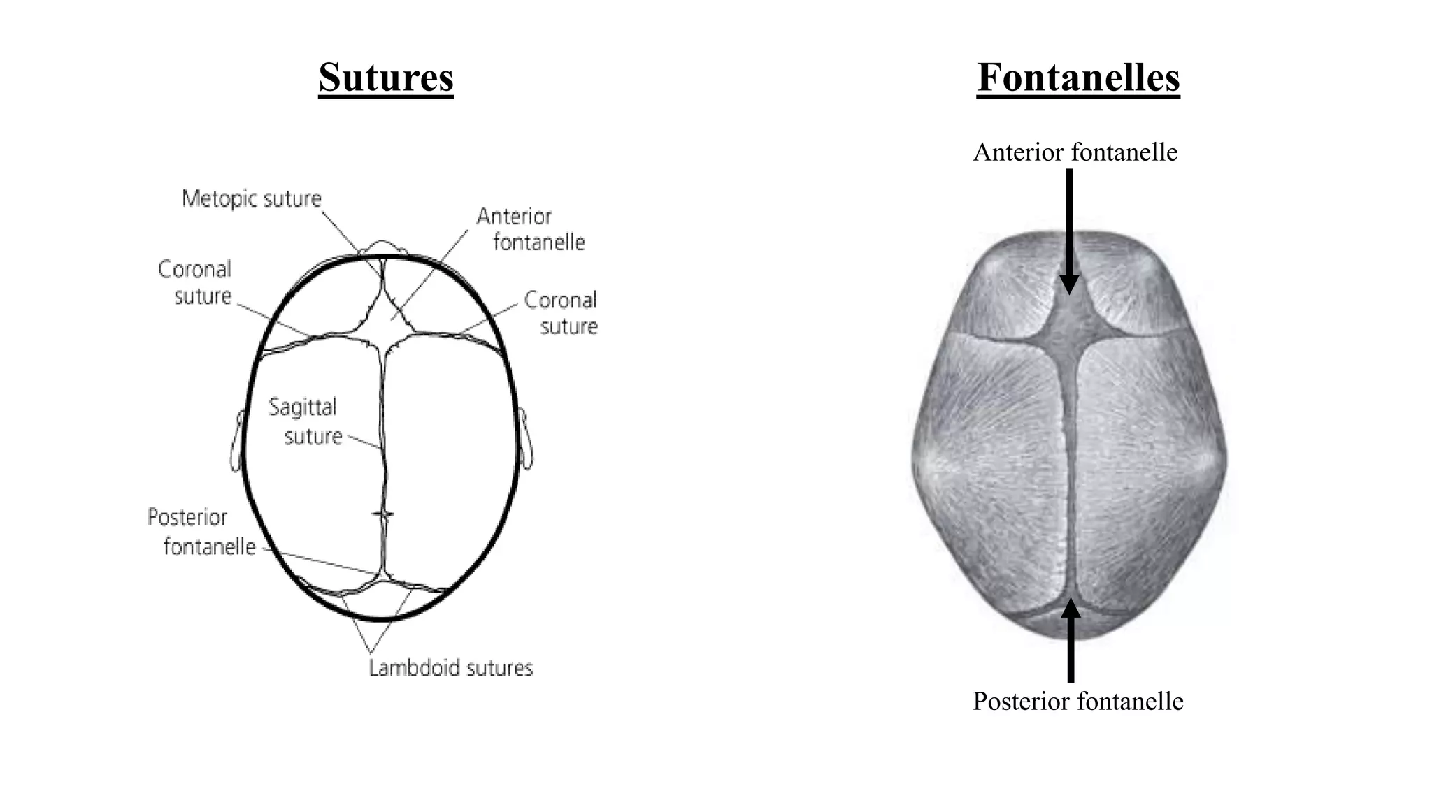 Fetal skull | PPT