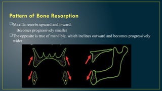 imppression techniques for edentulous jaws | PPTX