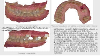Impresiones en protesis fija | PPTX