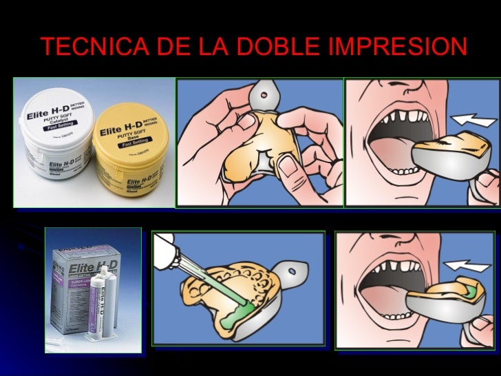 Impresiones Definitivas