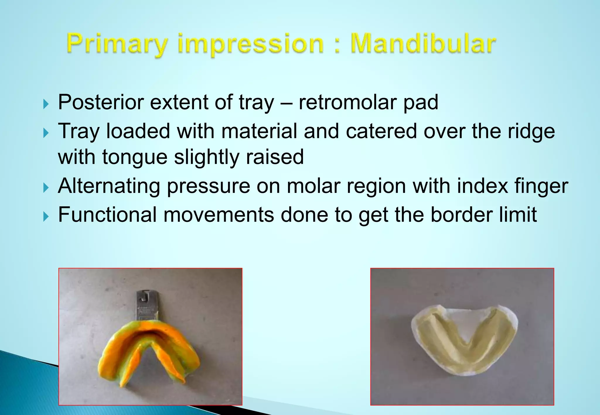 Impression for CD | PPTX