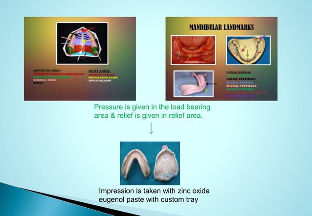 Impression for CD | PPTX