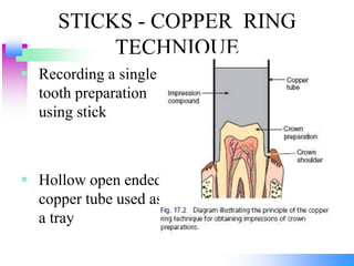 Impression compound | PPTX
