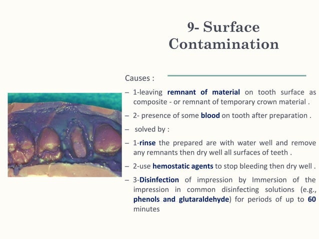 Impression errors presentation | PPT