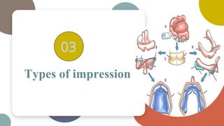 Impression for complete denture.pptx