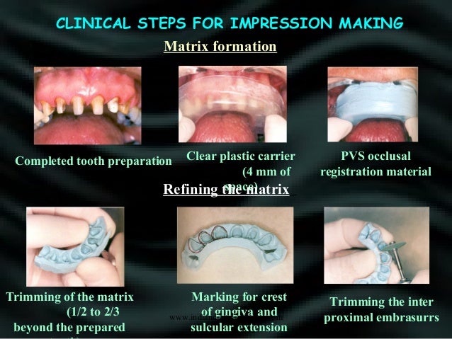 Impression material final /dental courses