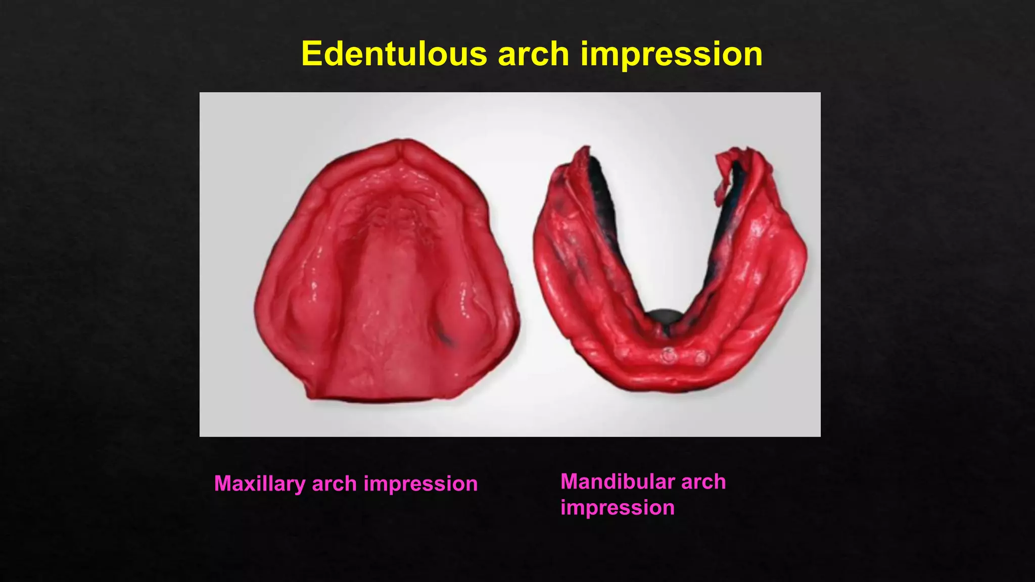 Impression materials classification and techniques | PPTX