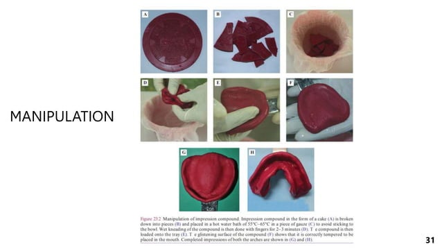 IMPRESSION MATERIALS USED IN PROSTHODONTICS | PPTX | Oral care ...