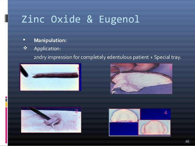 Impression materials 1