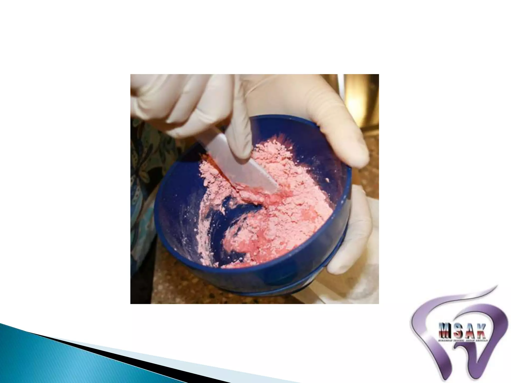 Impression materials agar and alginate | PPTX