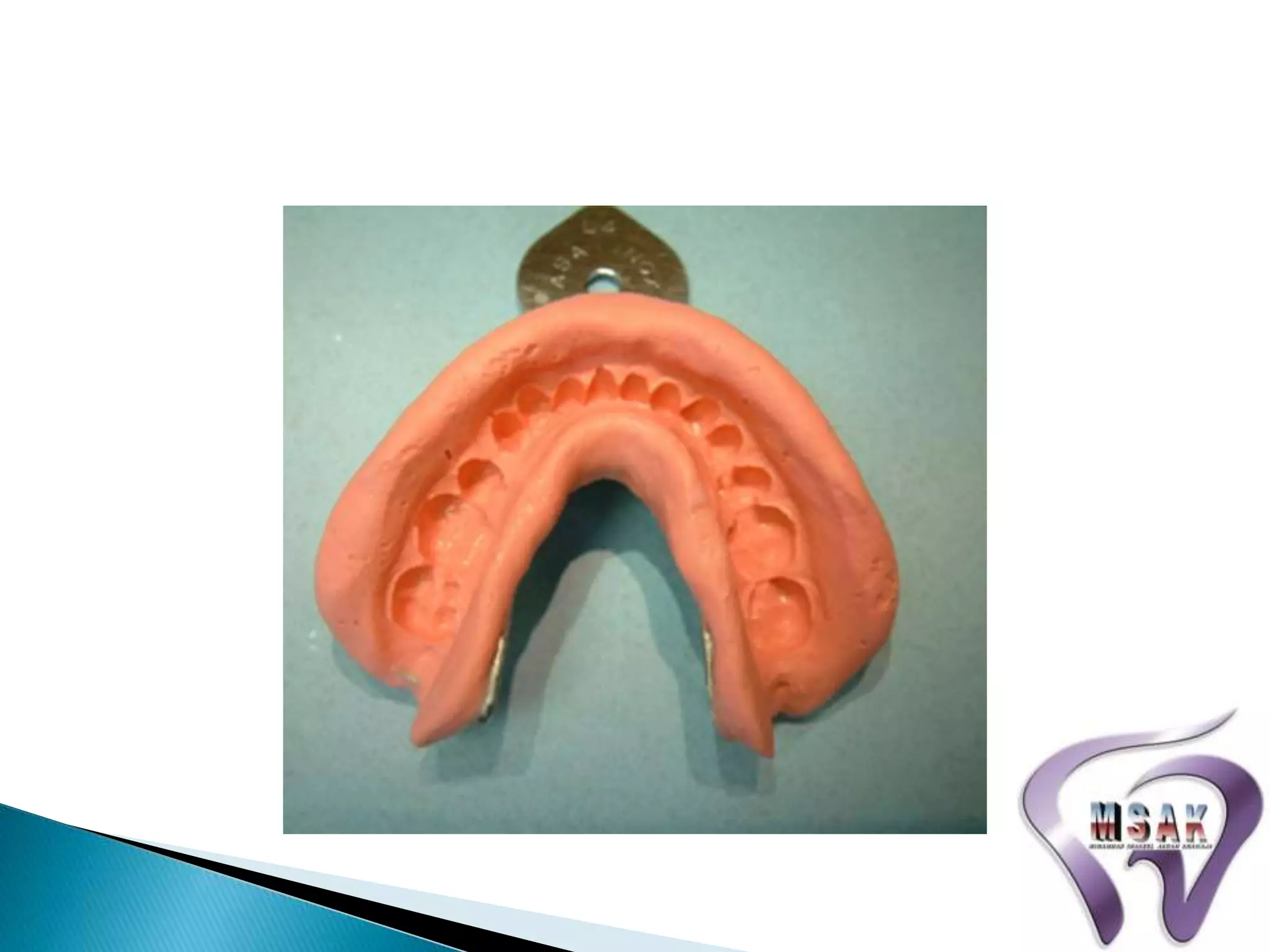 Impression materials agar and alginate | PPTX