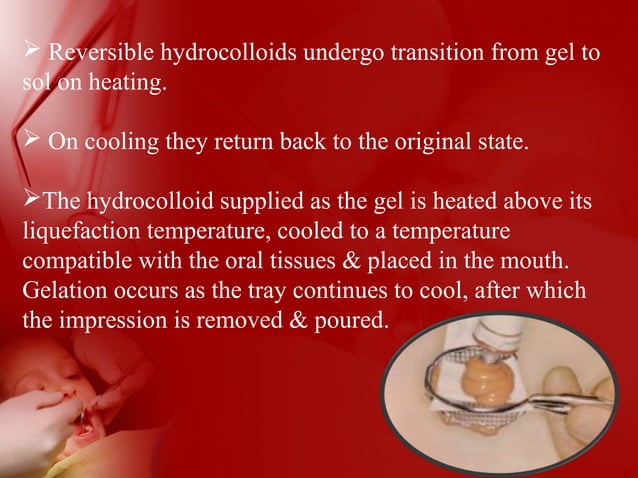 Impression materials and techniques | PPT | Dental Health | Diseases ...