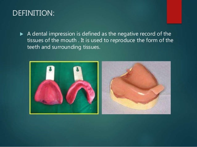 Impression materials for complete denture