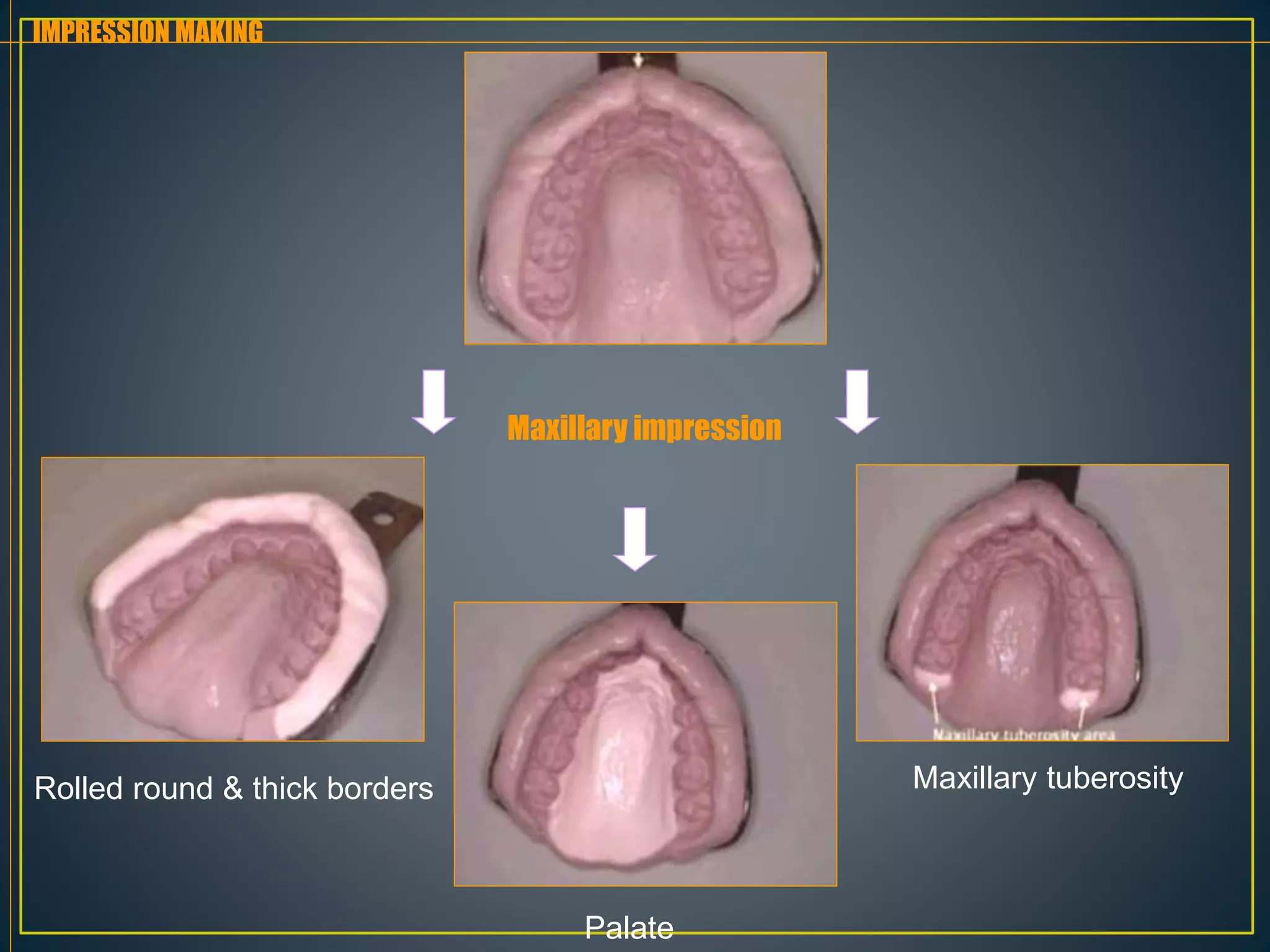 Impression materials in orthodontics | PPTX