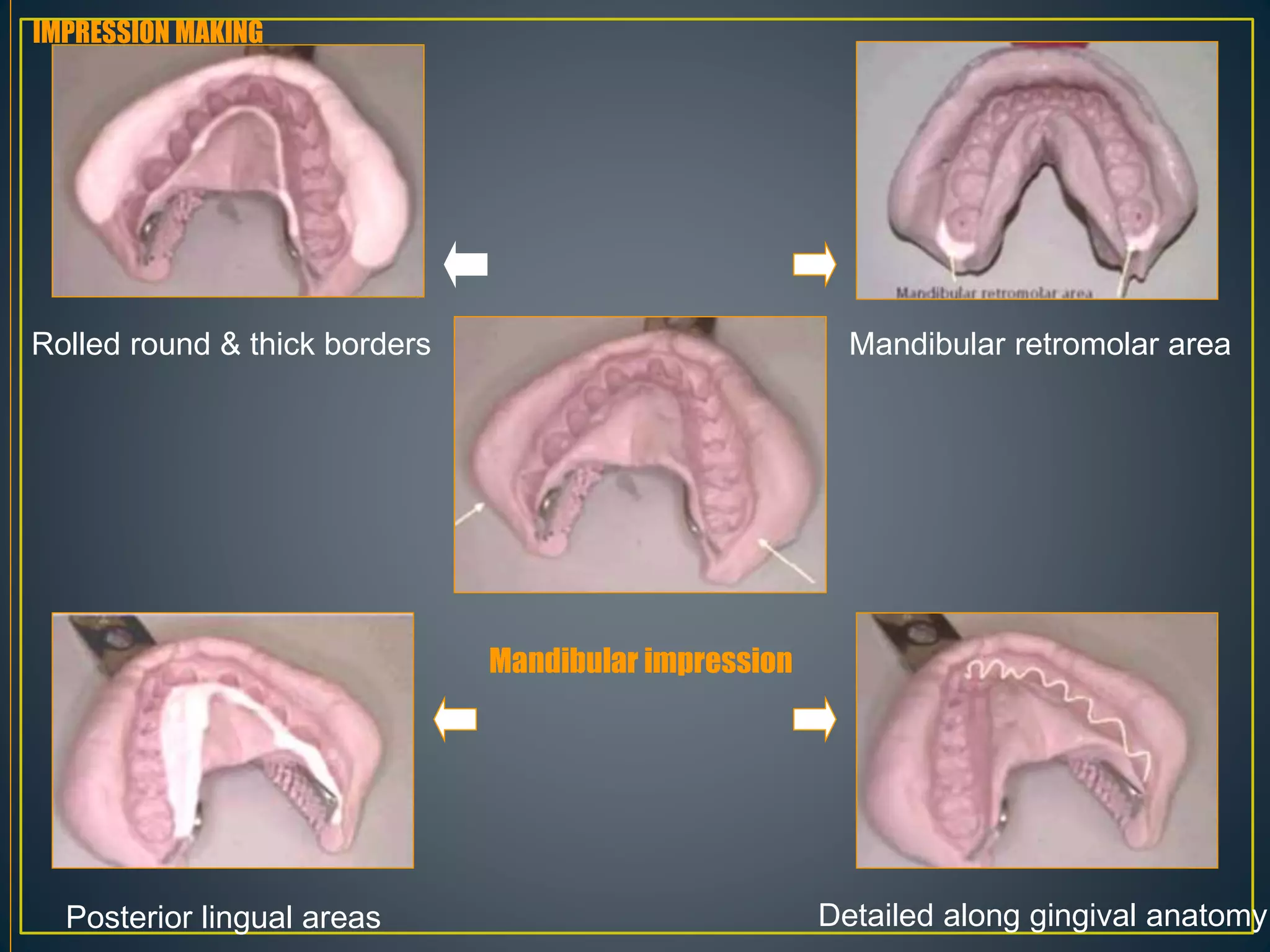 Impression materials in orthodontics | PPTX