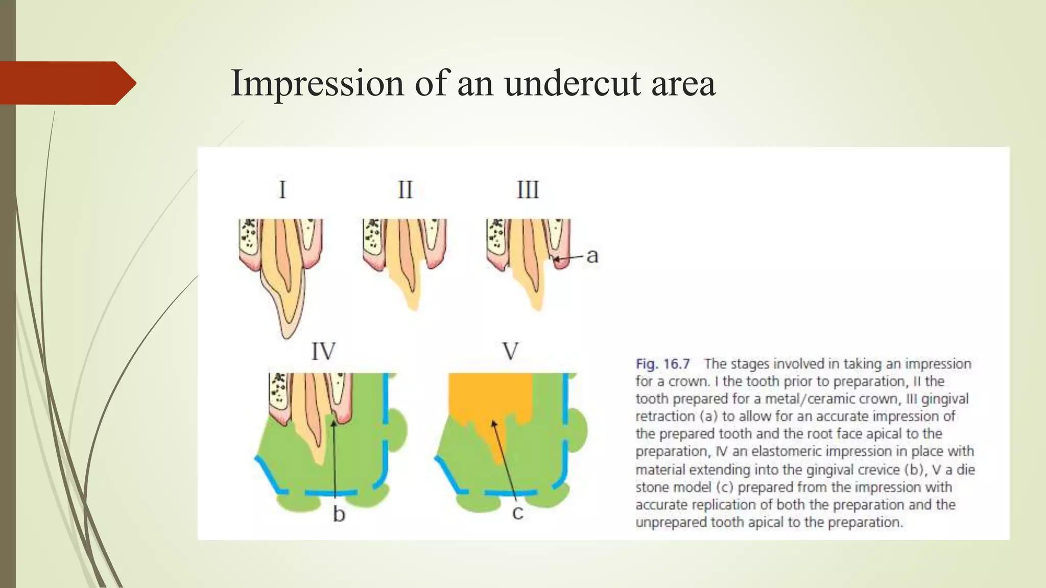 Impression materials, introduction, classification and requirements | PPTX