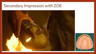 Impression Materials Part - 1 | PPT