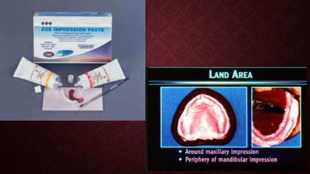 Impression material & procedures | PPT