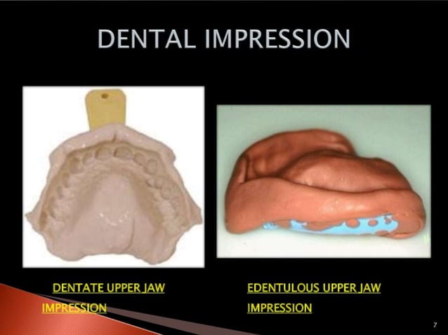 all about the dental impression materials . | PPTX