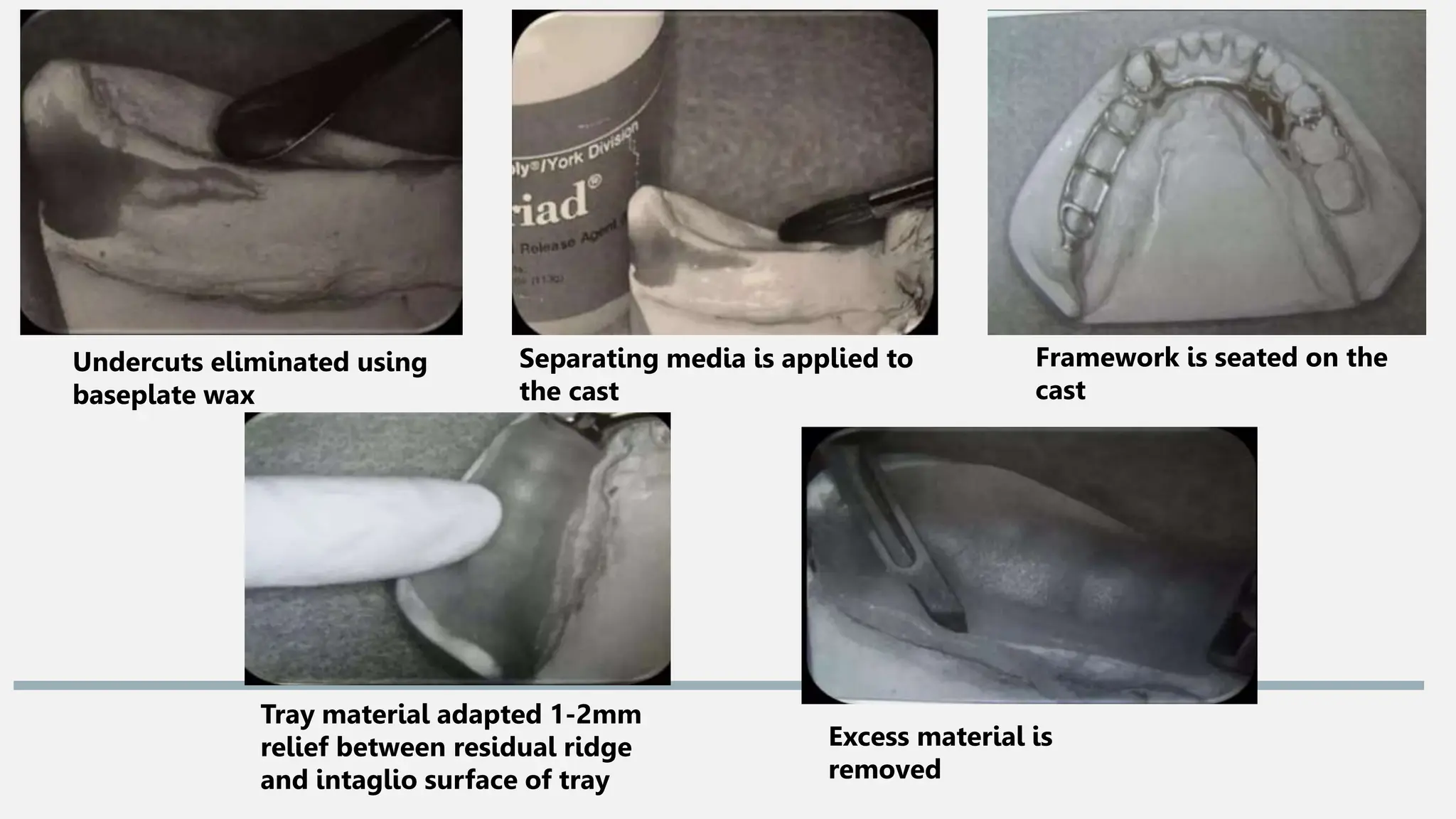 IMPRESSION MATERILS IN Removable partial denture in prosthodontics | PPTX