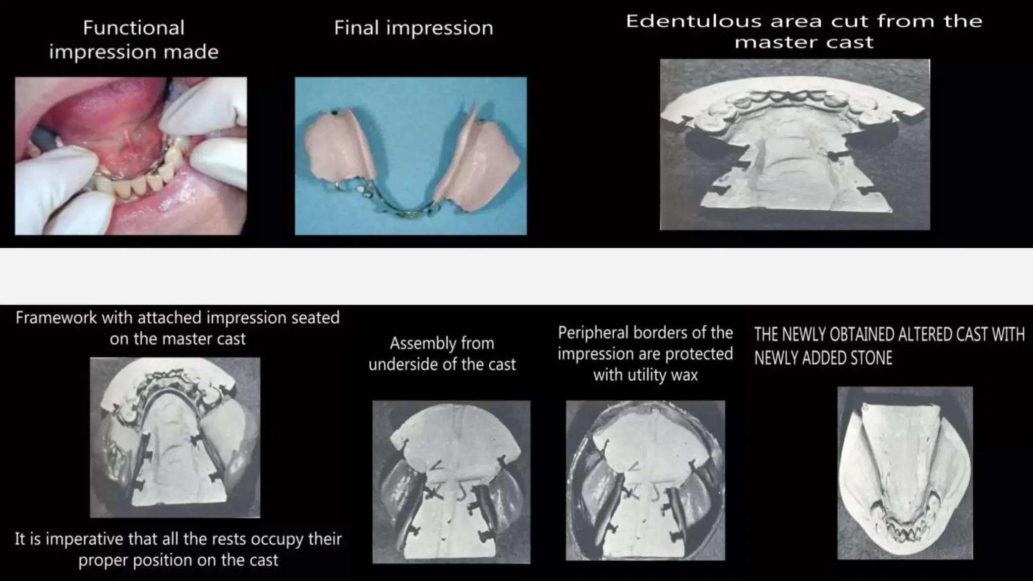 IMPRESSION MATERILS IN Removable partial denture in prosthodontics | PPTX