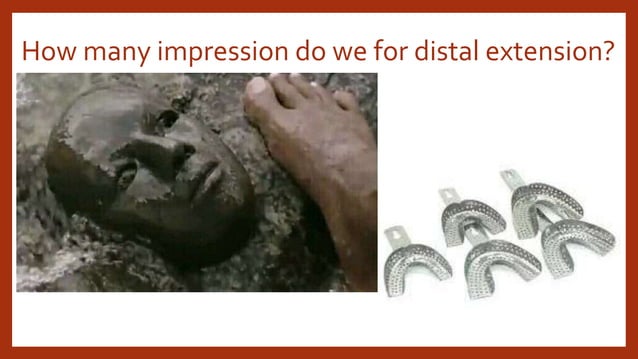 Impression procedure for distal extension RPD.pptx | Oral care ...