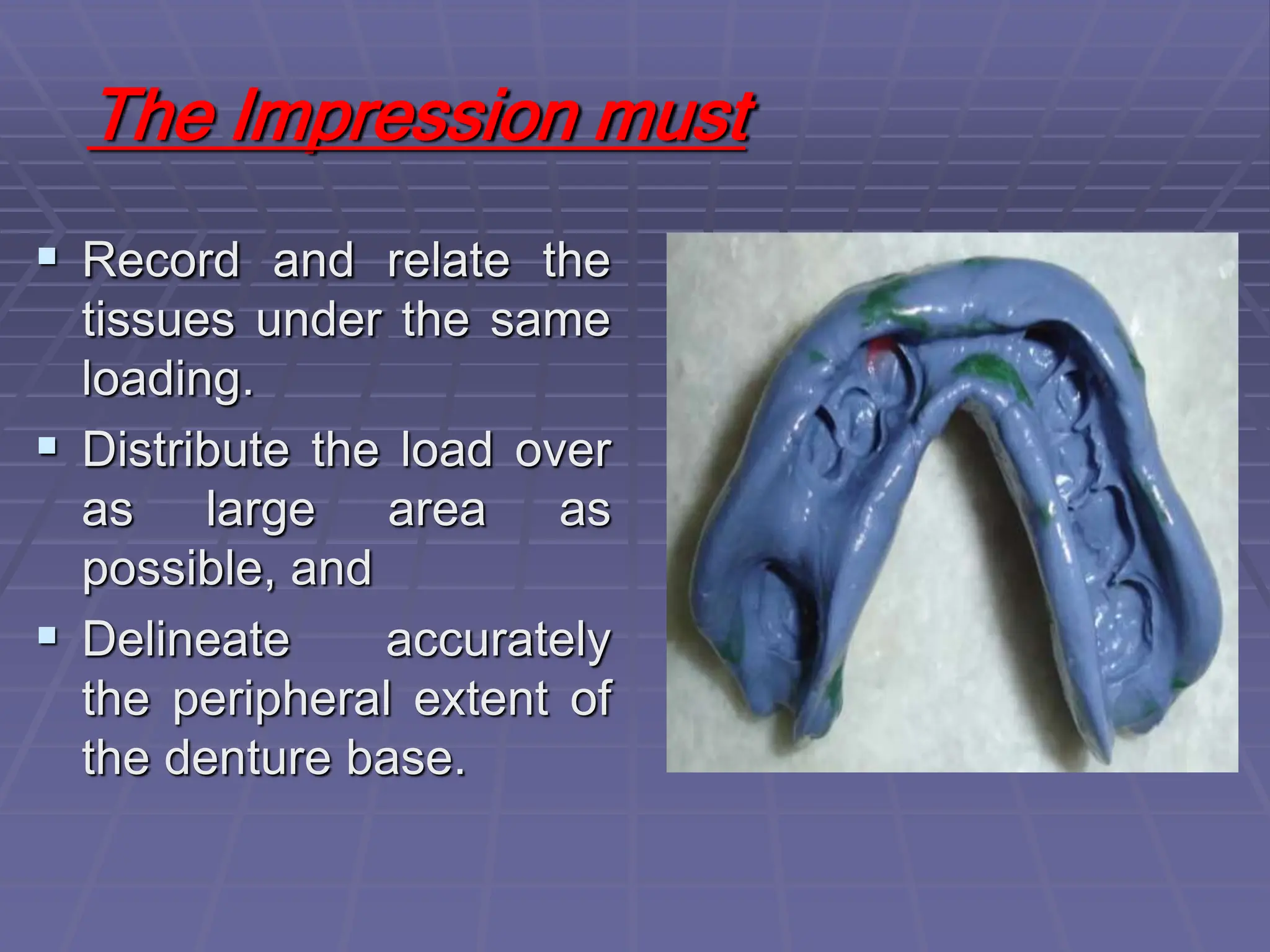 Impression Procedure for RPD’s- mandy.ppt
