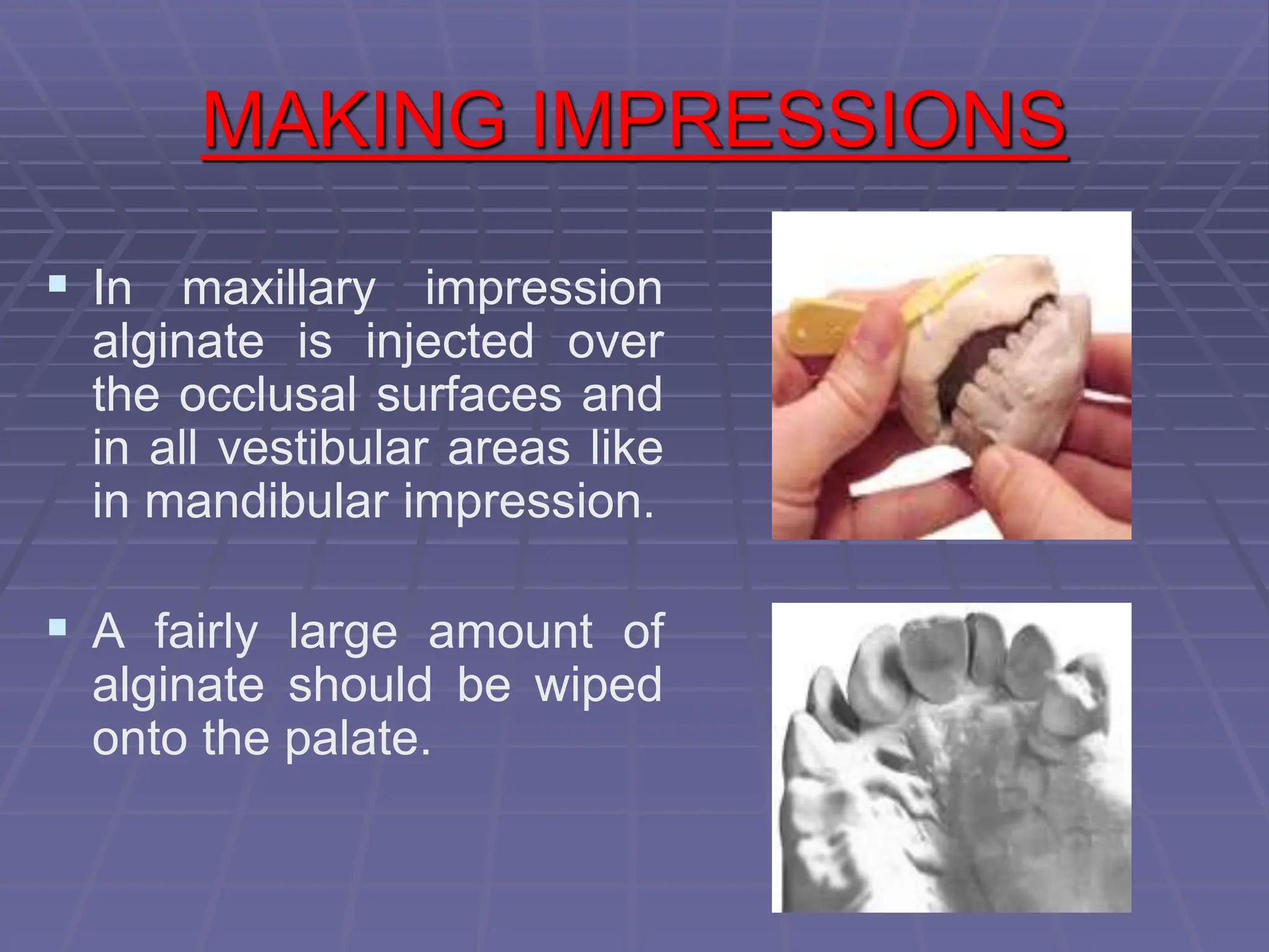Impression Procedure for RPD’s- mandy.ppt