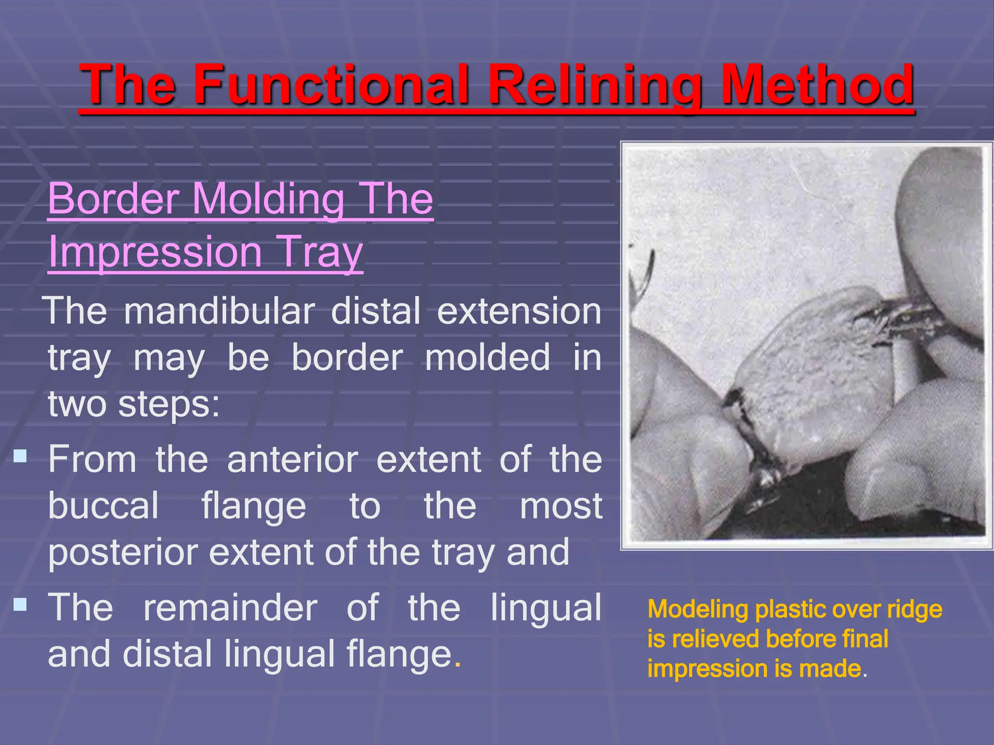 Impression Procedure for RPD’s- mandy.ppt