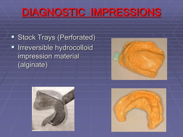 Impression Procedure for RPD’s- mandy.ppt