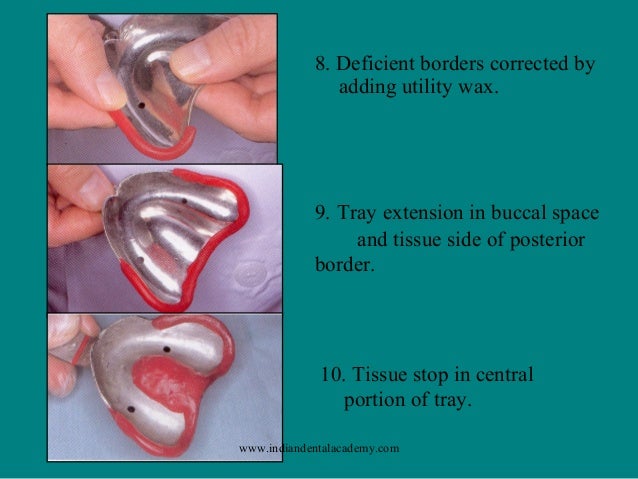 Impression procedures comlete denture/dental courses