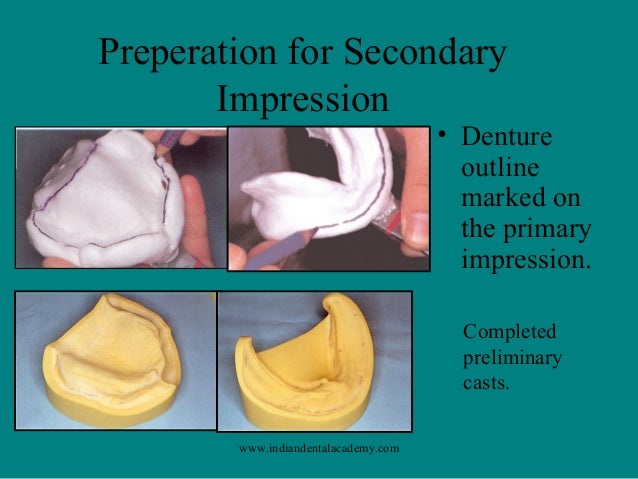 Impression procedures comlete denture/dental courses