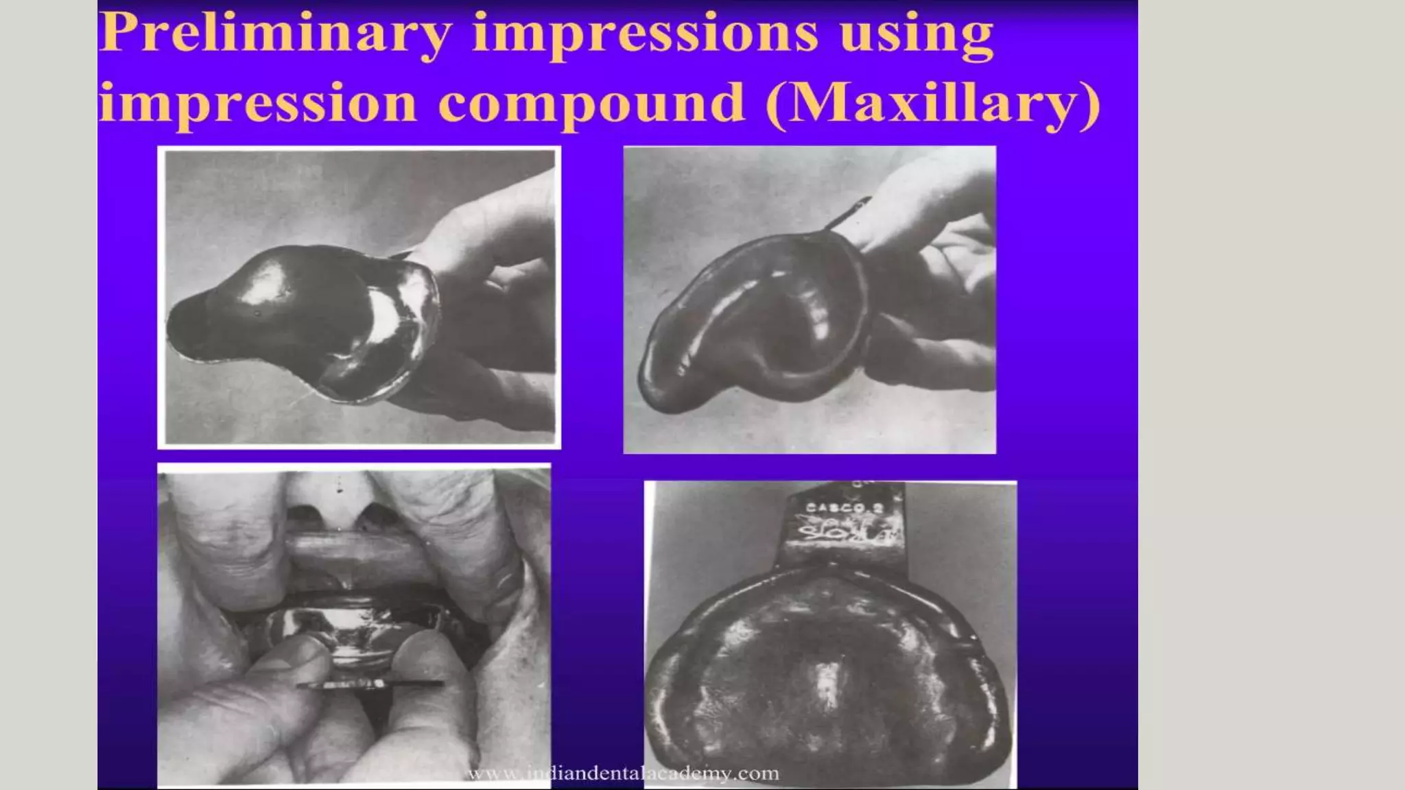 IMPRESSION PROCEDURES FOR COMPLETE DENTURES.pptx