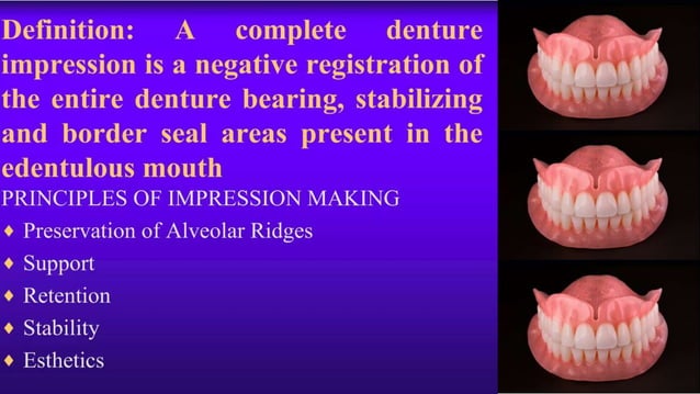 IMPRESSION PROCEDURES FOR COMPLETE DENTURES.pptx