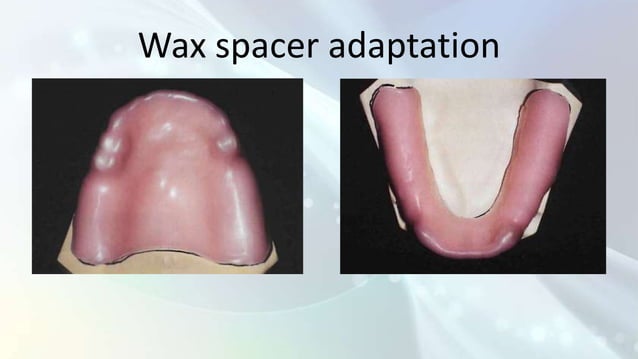 Impression - RPD | PPTX | Oral care | Personal Care