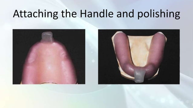 Impression - RPD | PPTX | Oral care | Personal Care