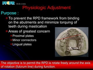 Impressions and physiologic adjustment | PPT