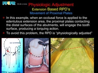 Impressions and physiologic adjustment | PPT