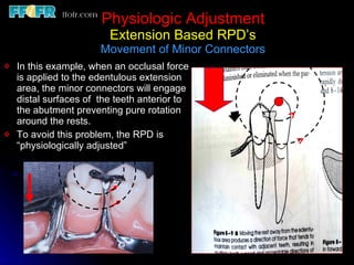 Impressions and physiologic adjustment | PPT