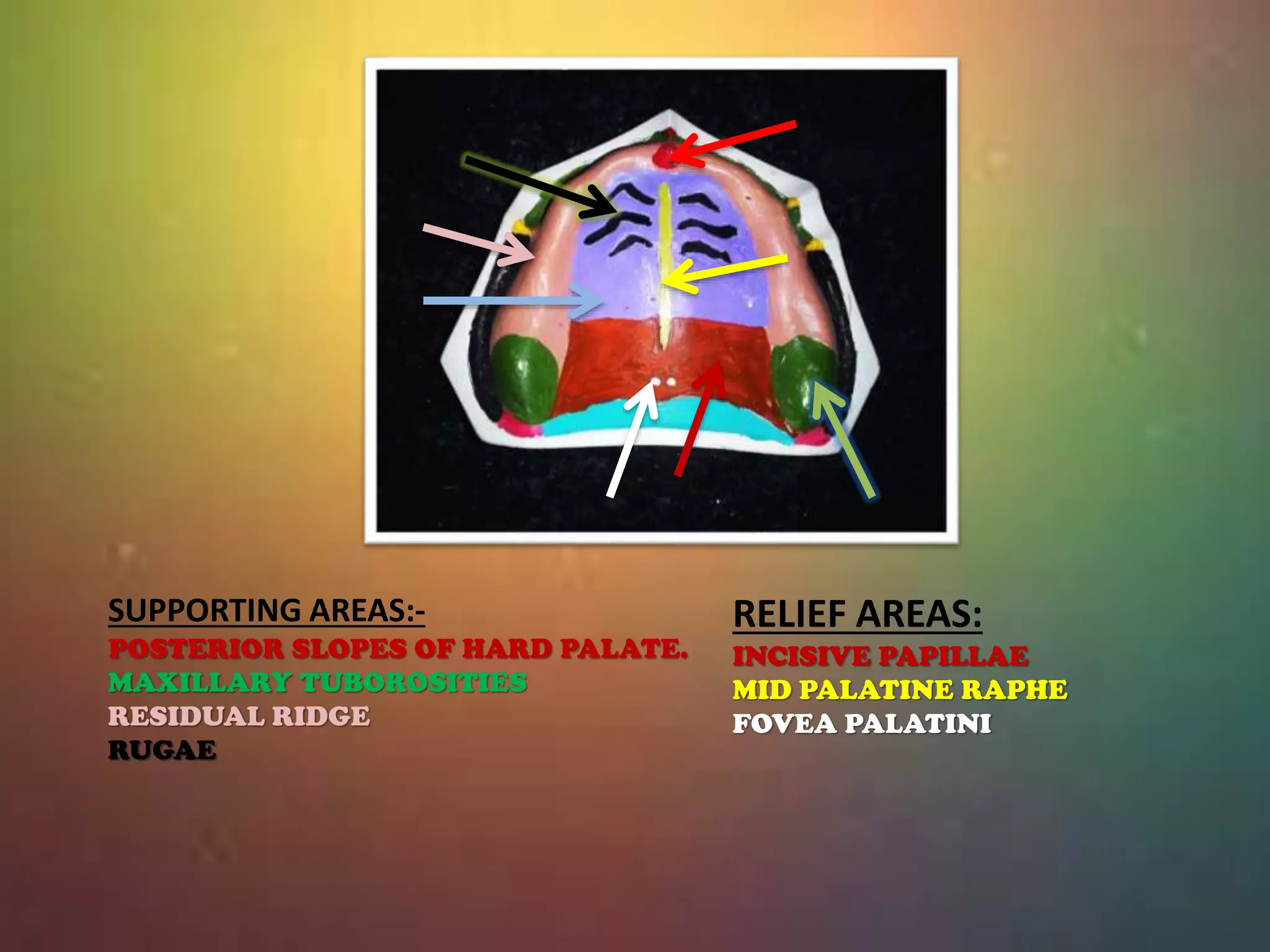 Impressions in complete dentures | PPTX
