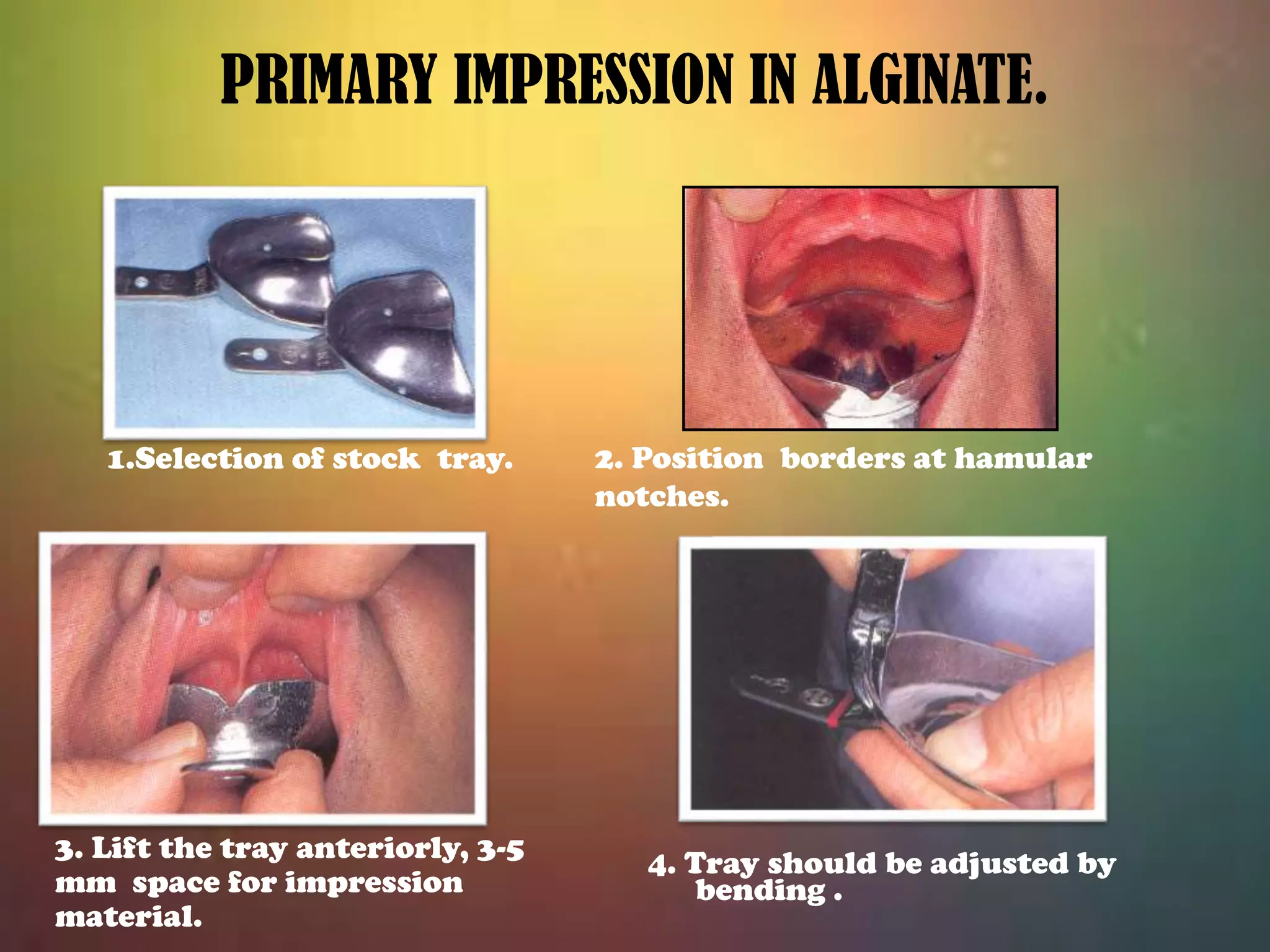 Impressions in complete dentures | PPTX