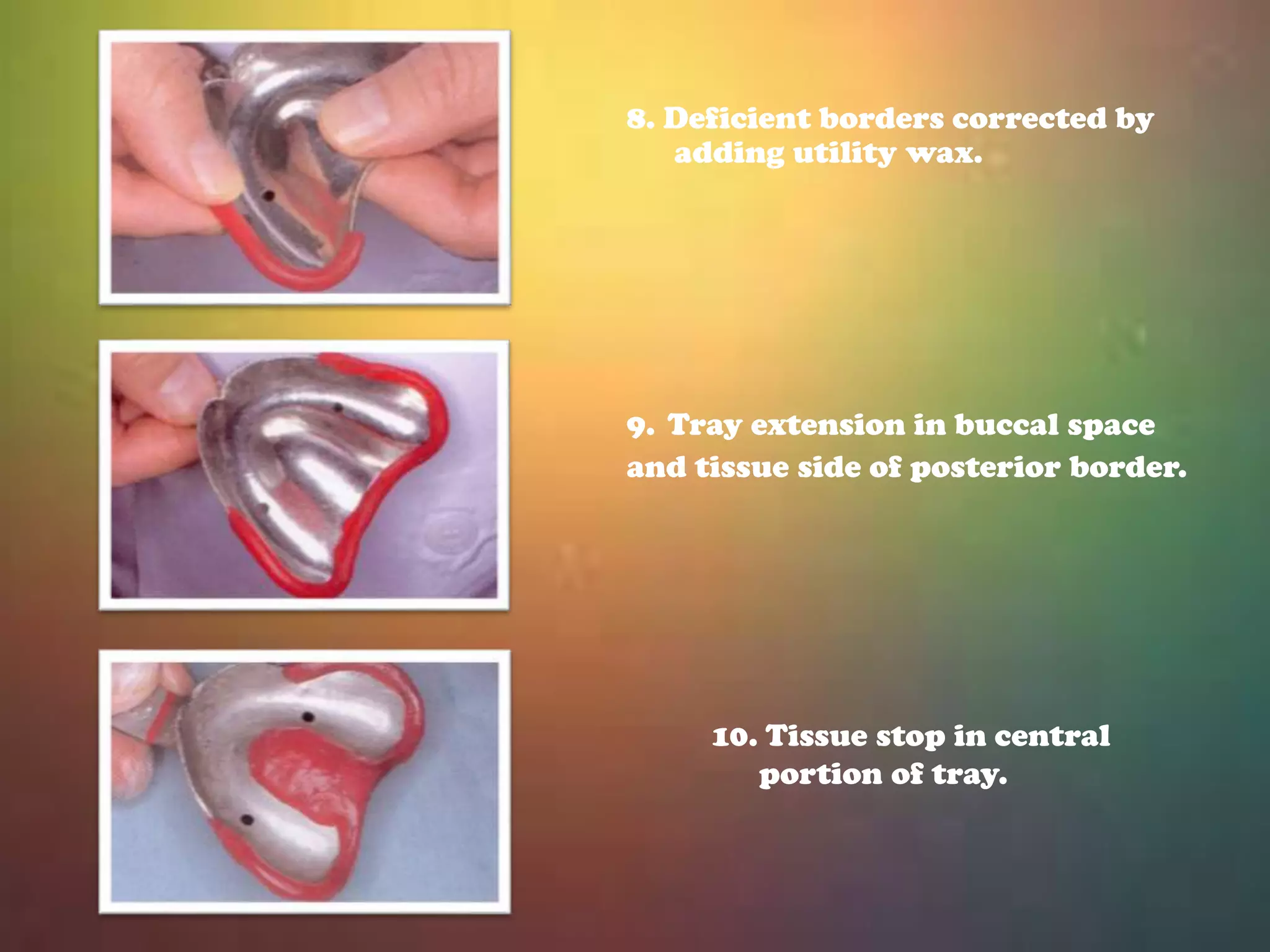 Impressions in complete dentures | PPTX