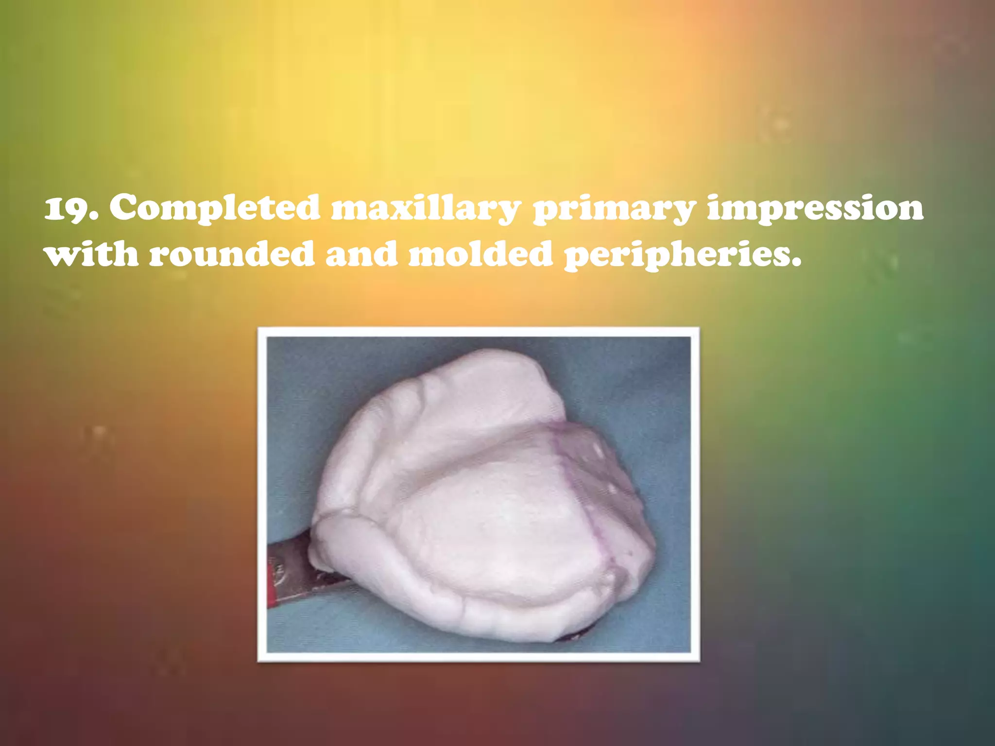 Impressions in complete dentures | PPTX